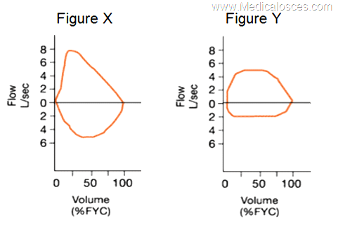 Shown here are two flow-volume loops. ~ Medical OSCES